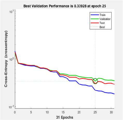 Figure 4 From Ecg Signal Classification Based On Neural Network Semantic Scholar