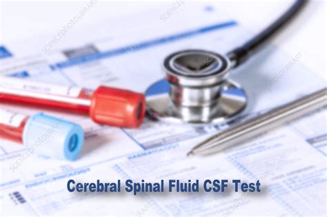 Cerebral Spinal Fluid Test Conceptual Image Stock Image F037 1133 Science Photo Library
