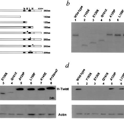 Subcellular Immunolocalization Of The Wild Type And Mutant Twist