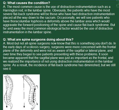 Flatback Syndrome Causes Symptoms And Treatment
