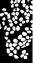 Overlaying Binary Masks On Images In Matlab Andrew Janowczyk