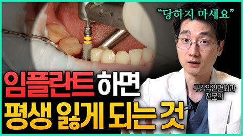 임플란트 하기 전 필수시청 이런 곳에서는 절대 임플란트 하시면 안됩니다 Youtube