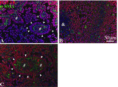 Interstitial And Peritubular Cells Are Required For Re Construction Of