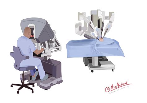 Robotic Prostatectomy Da Vinci Prostatectomy Prostate Cancer Treatment
