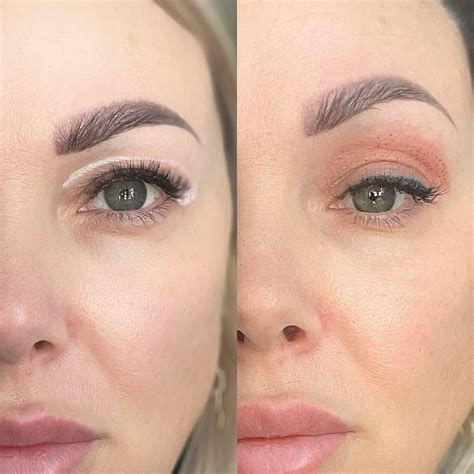 КОСМЕТОЛОГ•НАВЧАННЯ•БОТОКС•ГУБИ•НИТКИ•КРІО•ЕЛОС ‼️ДУЖЕ ШКОДУЮ‼️ що не зробила це раніше Довго