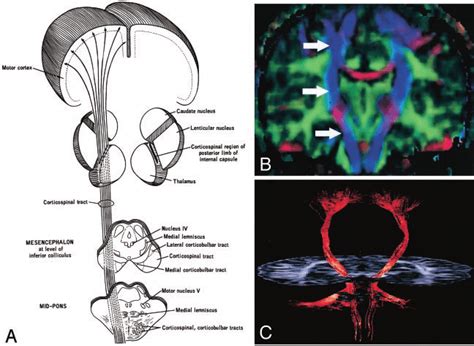 Corticobulbar Tract In Spinal Cord