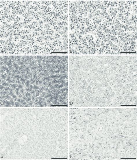 Liver Of Laying Hens Subjected To Diets With Different Ratios Of