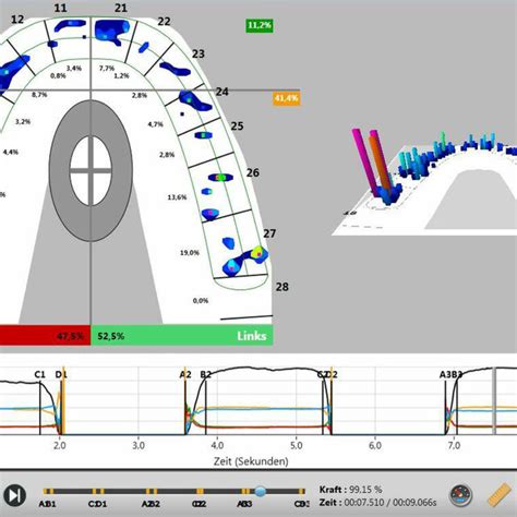 T Scan System Version 9 1 Sensor Handpiece T Scan Novus Handpiece Download Scientific