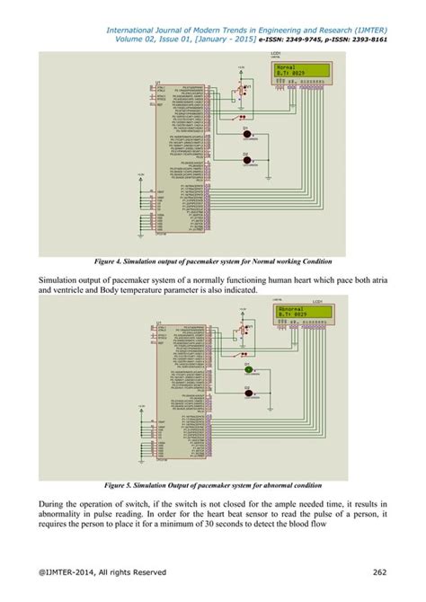 android based fail safe dual chamber cardiac integrated pacemaker device using bluetooth