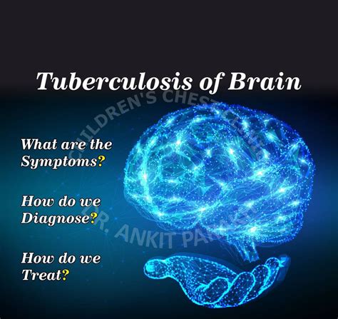 Tuberculosis Of The Brain Dr Ankit Parakh Indias Best Pediatric Pulmonologist Chest