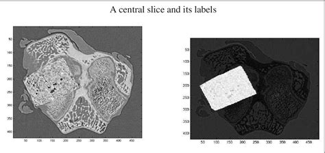 Figure 11 From Feature Selection In Classification Of Biomedical High