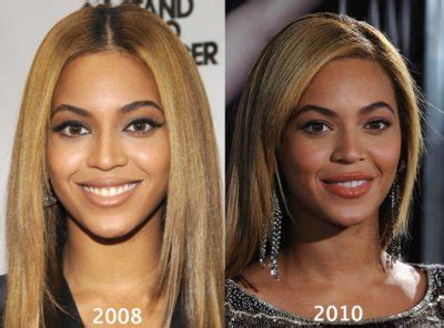 Beyonce Plastic Surgery Before And After Photos Surgeons Opinion