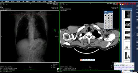 Cs体系结构的多媒体数据库管理信息系统pacs 知乎