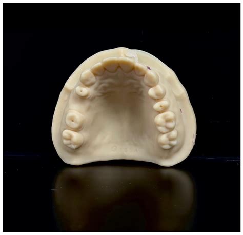 Dimensional Accuracy Of Polyether Elastomeric Impression Materials