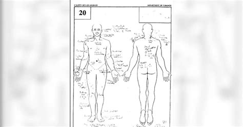 Khám Nghiệm Tử Thi Michael Jackson đÃ ượ àược Phát Hành Những Chi Tiết đáng Sợ Của Những Ng ày