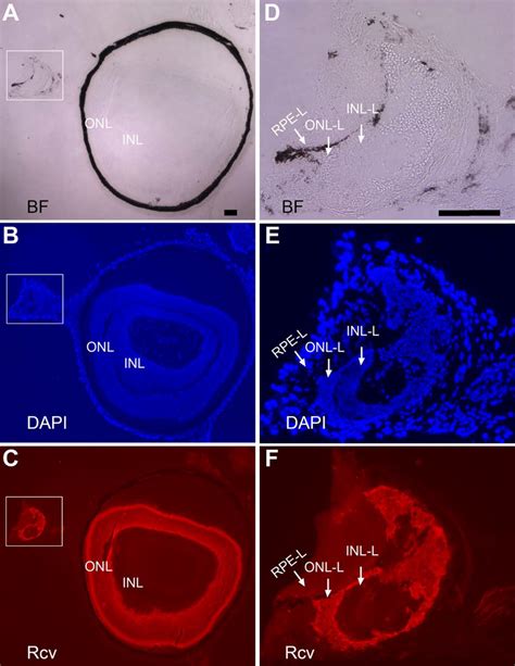 Retina Like Tissue Exterior To The Eyecup A C Bright Field View A Download Scientific