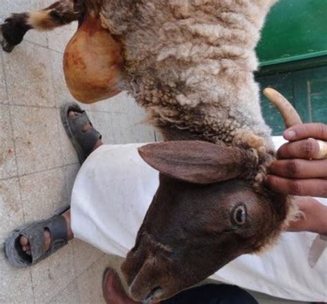 Aspiration Of Pus From An Abscess Fig 12 Presternal Abscess In A