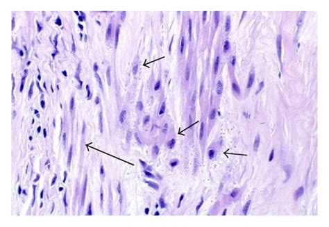 Phenotypic Transformation Loss Of Lateral Bars Lateral Bars Arrows