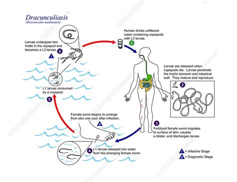 Guinea Worm Parasite Life Cycle Stock Image C009 6231 Science Photo Library