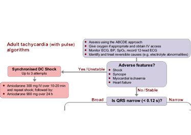 Resuscitation Council UK Advanced Life Support The Tachycardia Algorithm