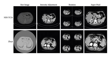 Ct Slice Presentation With Various Image Quality Control Means From Two