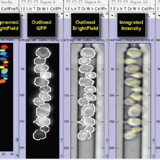 Cell Segmentation And Feature Measurement Both Brightfield And Download Scientific Diagram