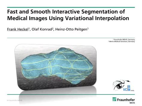 ppt fast and smooth interactive segmentation of medical images using