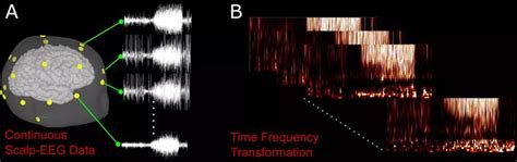 Deep Learning Models For Automatic Seizure Detection In Epilepsy