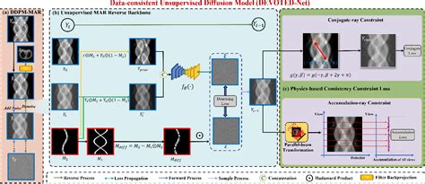 Figure From Data Consistent Unsupervised Diffusion Model For Metal Artifact Reduction