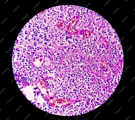 Premium Photo Microscopic Image Of A Cross Section Of An Appendix In