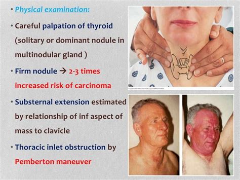 Approach To Thyroid Nodule Pptx Thyroid Disorders Endocrine And Metabolic Diseases