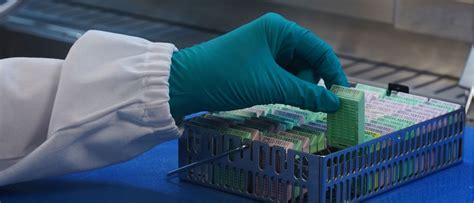 Traceability In Pathology Labs Ensuring Specimen Safety And Workflow Efficiency Milestone Medical