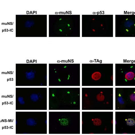 Intracellular Distribution Of Gfpgfp Ic Gal4gal4 Ic And P53p53 Ic