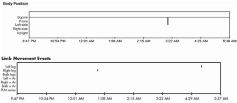 Generating The Polysomnography Report Neupsy Key