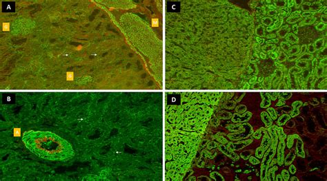 Immunofluorescence Patterns Observed In The Indirect Immunofluorescence Download Scientific
