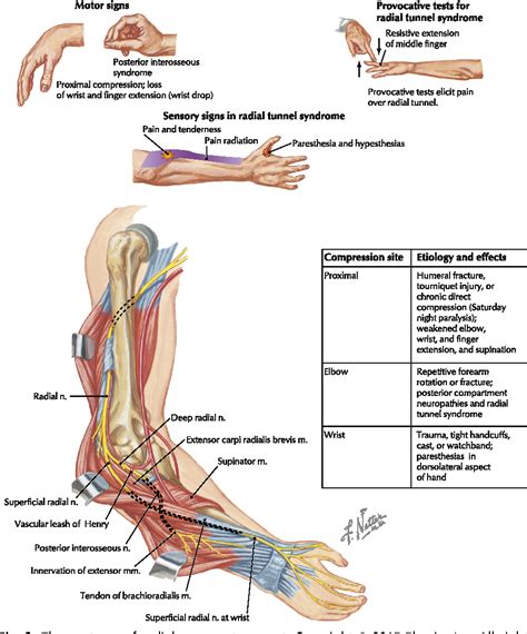 Ulnar Nerve Compression Ulnar Nerve Entrapment Exercises Treatment