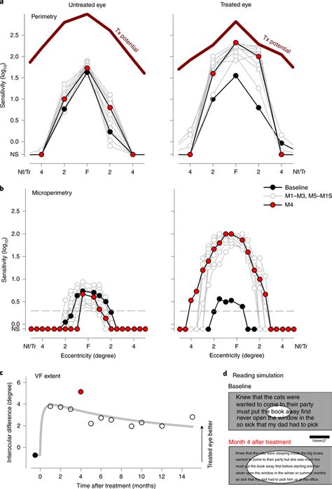 Improvement Of Foveal Sensitivity Expansion Of Visual Field And