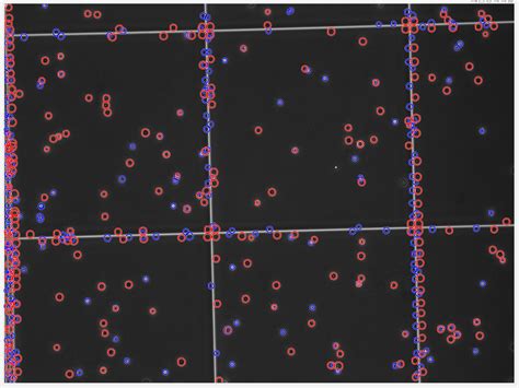 Image Processing Cell Counting And Property Analysis Using Matlab