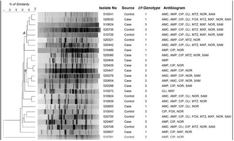 Not1 Restriction Patterns Of Genomic Dna Of Enterotoxigenic B Fragilis Download Scientific
