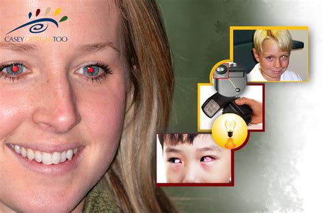 Capturing Moments Understanding And Eliminating The Red Eye Effect In Photographs Casey