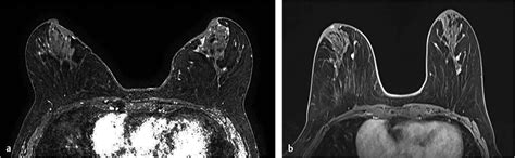 5 Diagnostic Mri Imaging Protocols And Technical Considerations Radiology Key