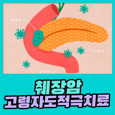 췌장암 고령자라도 치료에 적극 나서야 건강검진정보