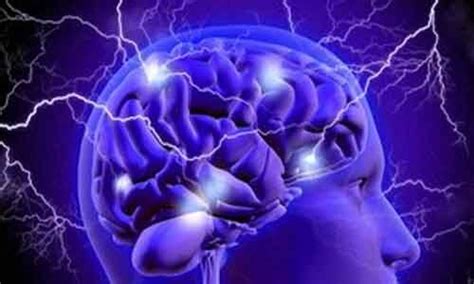 Post Stroke Seizures Linked To Increased Death And Disability