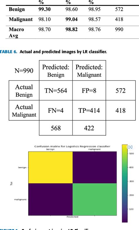 Figure 1 From Improved Segmentation Model For Melanoma Lesion Detection