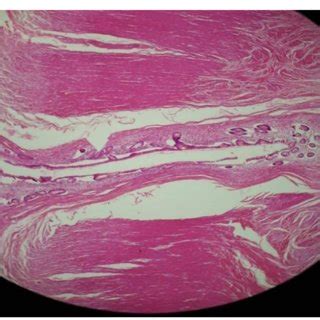 Microscopic View Of Appendix Tissue Download Scientific Diagram