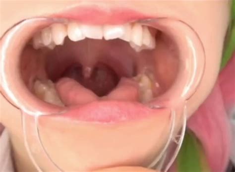 Japanese Girl Uvula Video 5