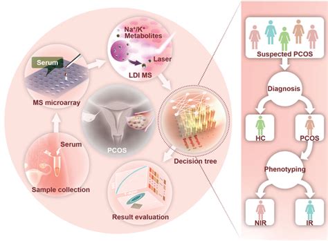 Schematic Workflow Schematic Illustration Of Polycystic Ovary Syndrome Download Scientific