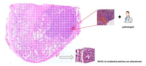 pathology meets large scale self supervised learning by mingu kang