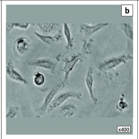 Proliferation Of A Suspension And B Adherent Mononucleated Cells