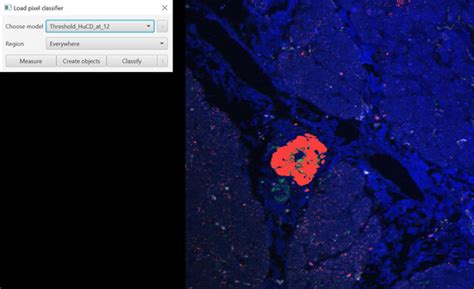 Use Script To Save Image With Threshold Overlay In Qupath Usage And Issues Imagesc Forum
